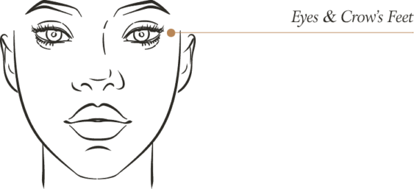 Crow's Feet & Eye Wrinkle Treatment Danvers MA |Roddy MedSpa